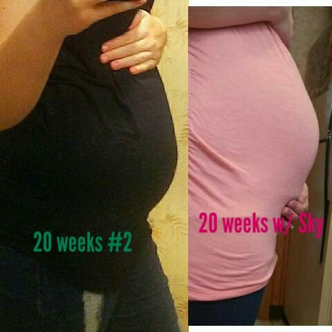 20 week belly comparison - Glow Community
