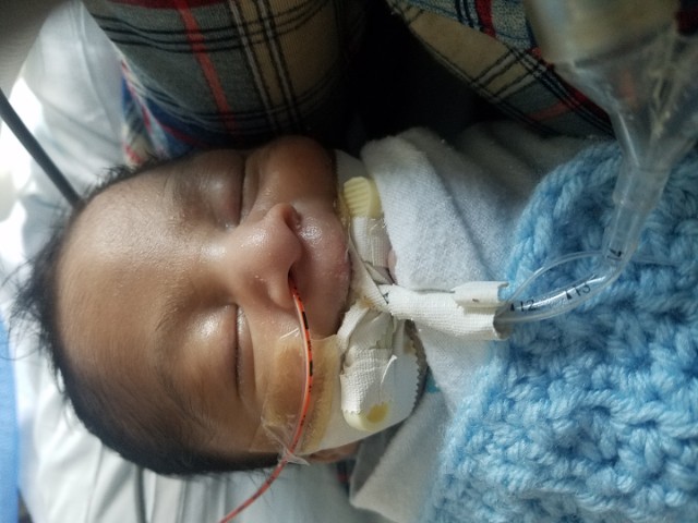 Baby born with one lung 😔 - Glow Community