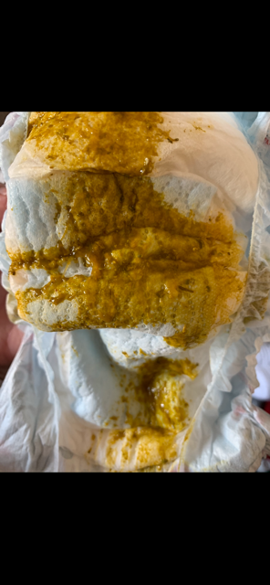 POOP pic *** are these normal EBF poops? 2 months old! - Glow Community