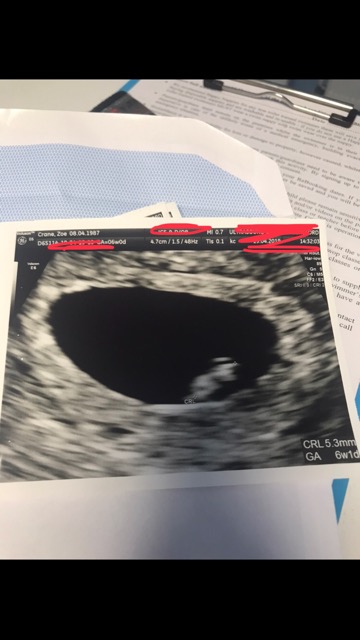 What was the size of your baby at 6 week scan - Glow Community