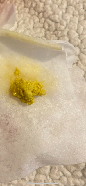Is my newborn sons poop normal? Recommendations for cow milk allergy ...