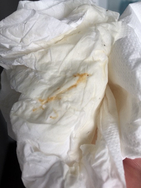 TMI start of Mucus plug???, - Glow Community