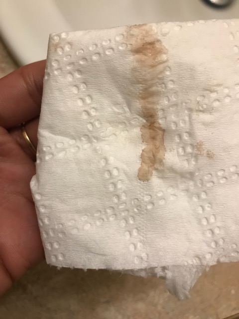 Can Implantation bleeding occur as late as 14 dpo?? - Glow Community