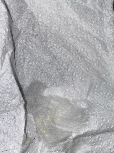 19 weeks and weird discharge - Glow Community