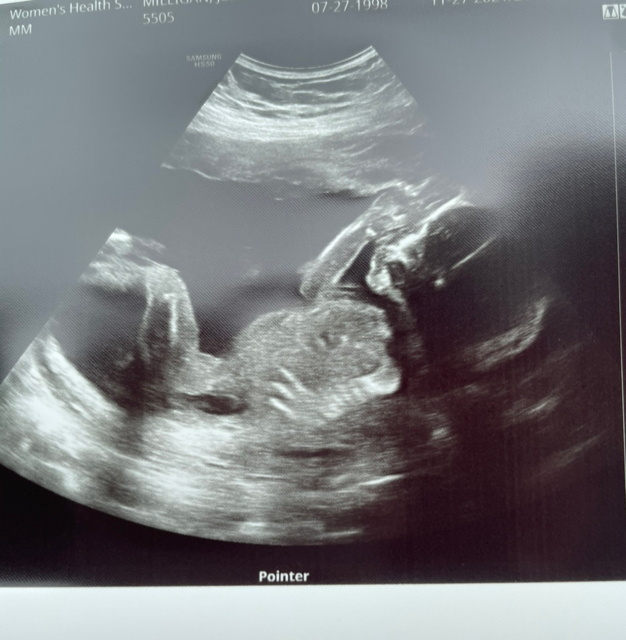 20 week Anatomy scan - Glow Community