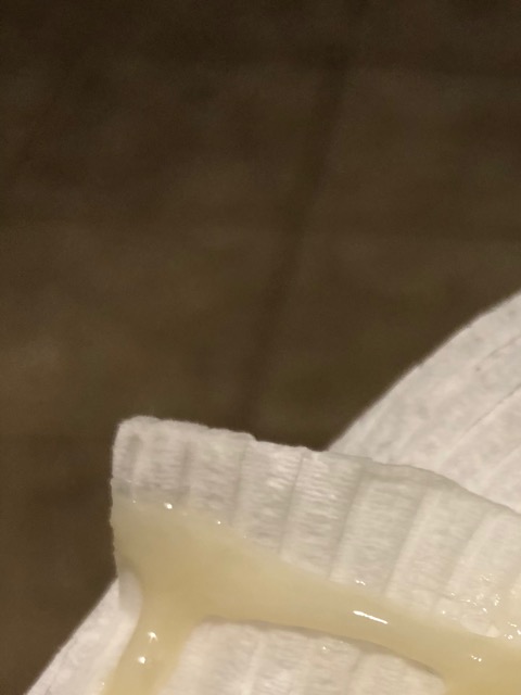 TMI - really heavy cervical mucus - Glow Community