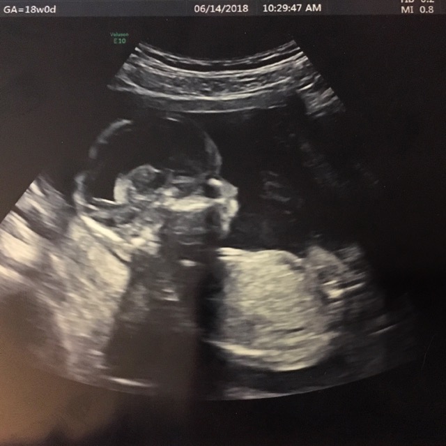 Anatomy Scan Done Today Glow Community