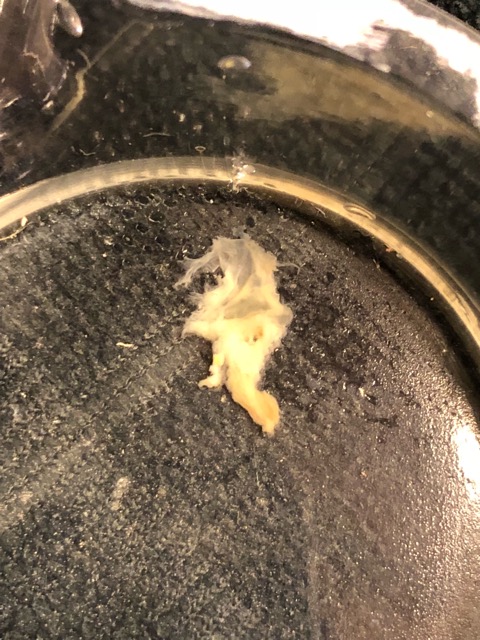 Does anybody know what this stringy white glob is? TMI photo - Glow ...