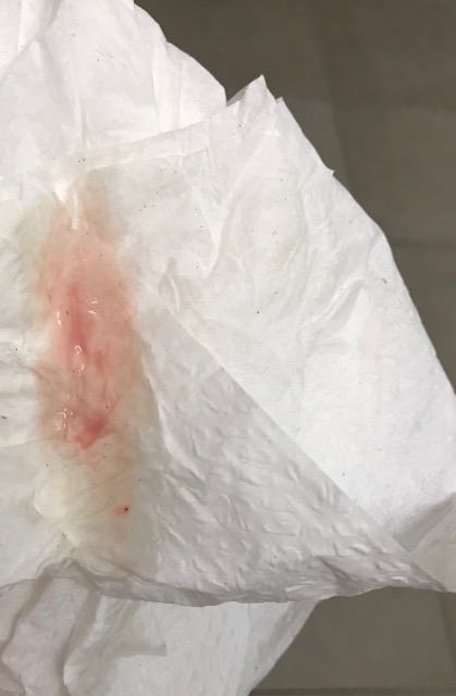 Could This Be Implantation Bleeding Or Early Period Glow Community could-this-be-implantation-bleeding-or-early-period-glow-community