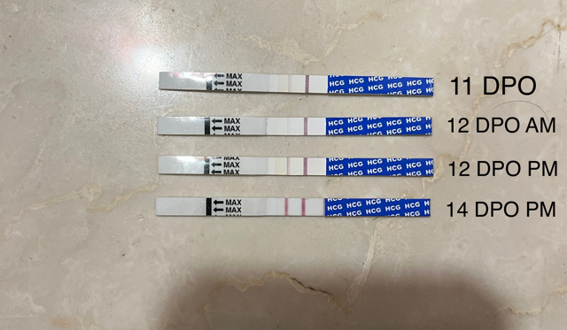 Line progression with ectopic pregnancy? - Glow Community