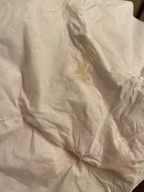 TMI TMI TMI Mucus plug or discharge? - Glow Community