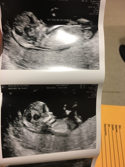 Nub theory - Girl ? How accurate - Glow Community