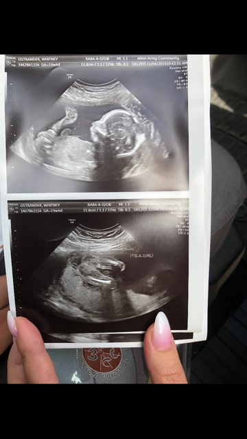 Anatomy scan/ gender reveal / baby kicks - Glow Community