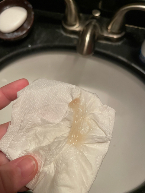 Bloody show or just mucus plug? I’m 5 cm dilated. It’s slightly pink ...