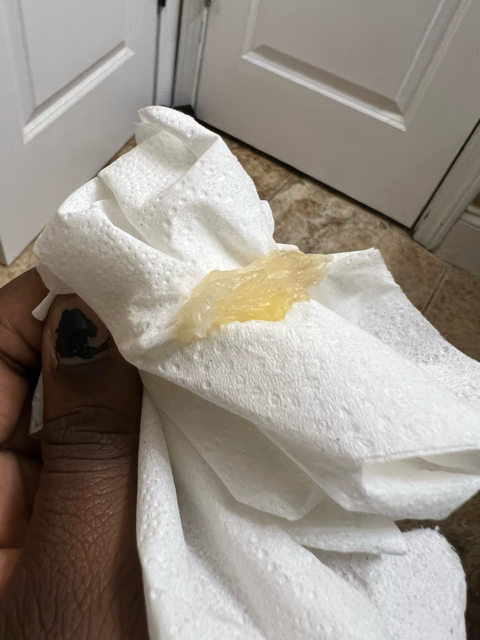 Can anyone explain what this is!! It’s clearish, dry, and super sticky ...