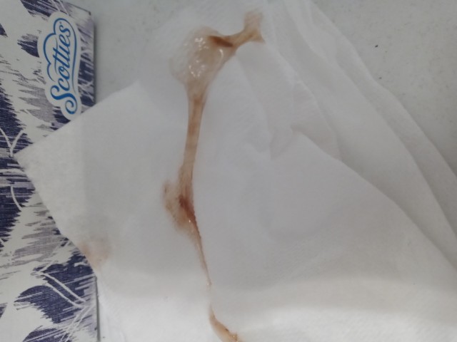Do You All Think It May Be Implantation Spotting Mucus Discharge I Have do-you-all-think-it-may-be-implantation-spotting-mucus-discharge-i-have