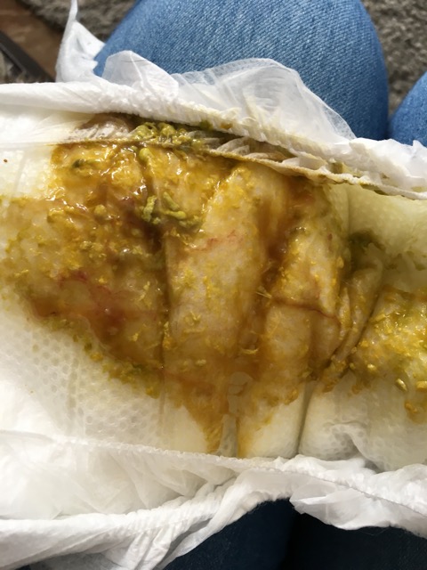 TMI, 7 week old bf baby, blood in poop, is this normal? - Glow Community