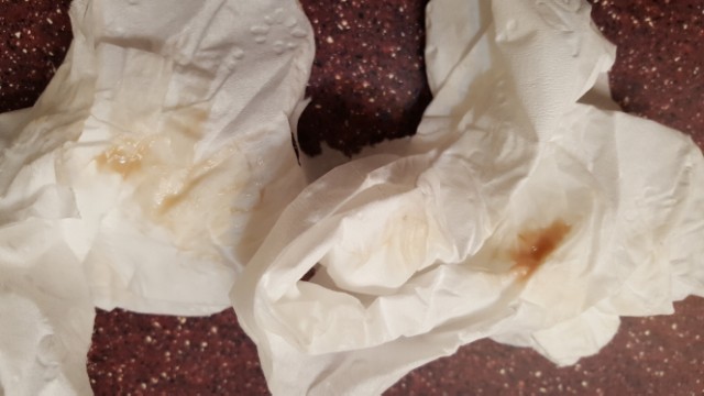 implantation bleeding? 9 days DPO - Glow Community