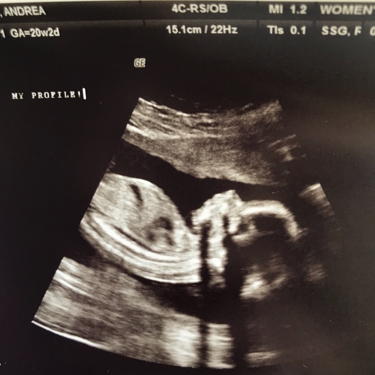 20-week-anatomy-scan-glow-community