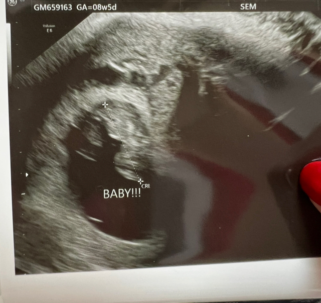 ultrasound today 🥰 transvaginal, measuring exactly on track for 8w5d, heart beat 180 ️ any ...