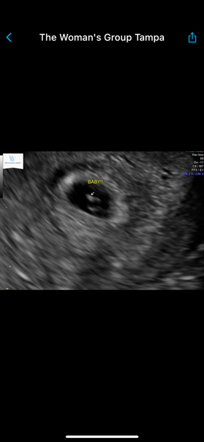 5 Weeks 6 Days Ultrasound Had To Go In To Discuss My Meds And Since I 5 Weeks 6 Days Ultrasound Had To Go In To Discuss My Meds And Since I