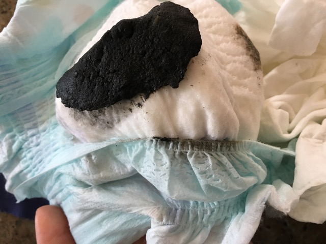 Black Poop Normal After Having Purple Carrot And Blueberry She Has Had Black Poop Twice So Far black-poop-normal-after-having-purple-carrot-and-blueberry-she-has-had-black-poop-twice-so-far