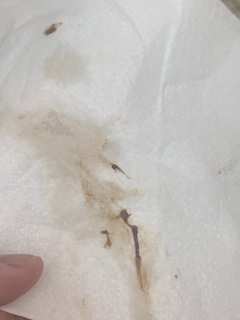 3w6d pregnant. Is this normal or is brown in color mucus it is not ...