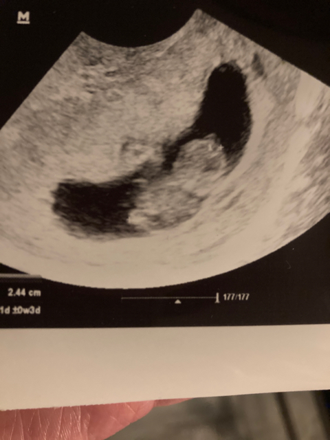 Our little rainbow baby at 8w4d with heart rate of 165💗 same exact heart rate as my oldest ...