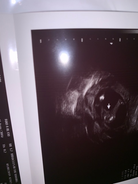 What does this look like ? Boy or girl ? It was the gender scan. - Glow ...