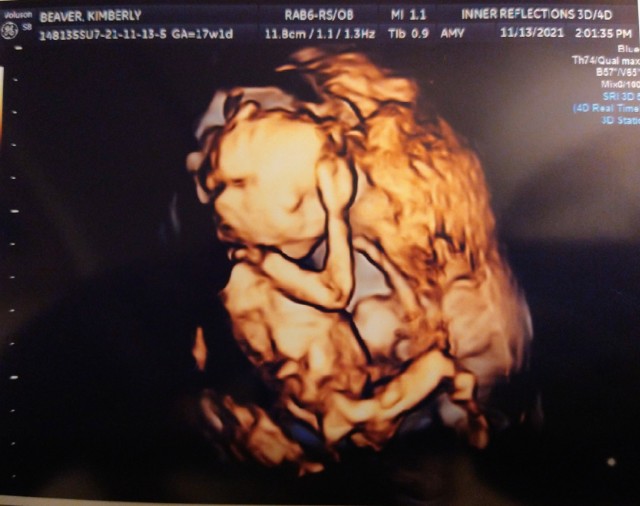 Had a private scan done today. Baby is most definitely a boy! He kept ...