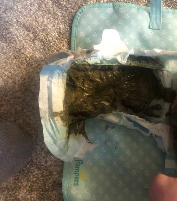 Sorry for the TMI!! My daughter is 4.5 months old and just has very ...