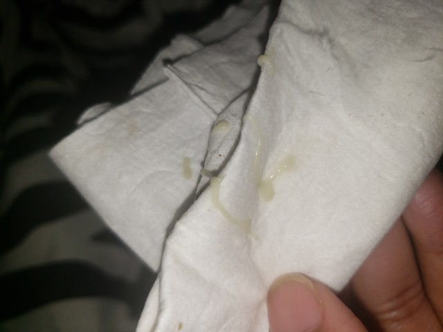 My 1st clogged duct since I've started breastfeeding on March 22nd. The ...