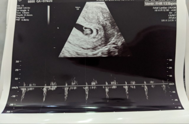 I'm 7 weeks 2 days, but baby is measuring at 6 weeks 5 days. Heart rate ...