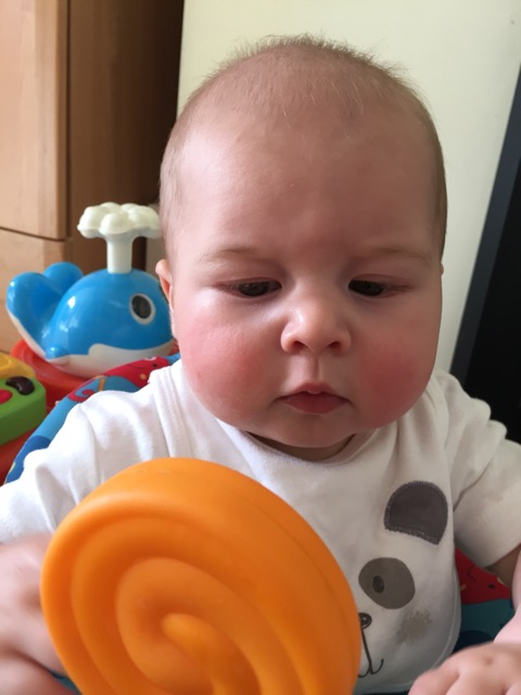 My 6 month old son has had red rashy type cheeks for a few days now. He ...