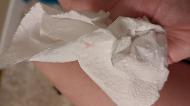 8dpo - could this be implantation bleeding? It's light pink! - Glow ...