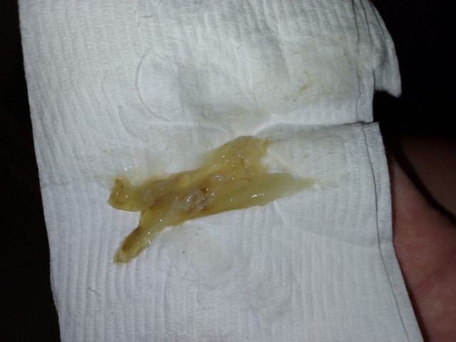 40 weeks today. 2 cm last apt she said. Back pain last night and just ...