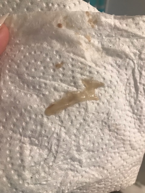 TMI....Y’all..FTM and I’ve had mucous discharge streaked with a light ...