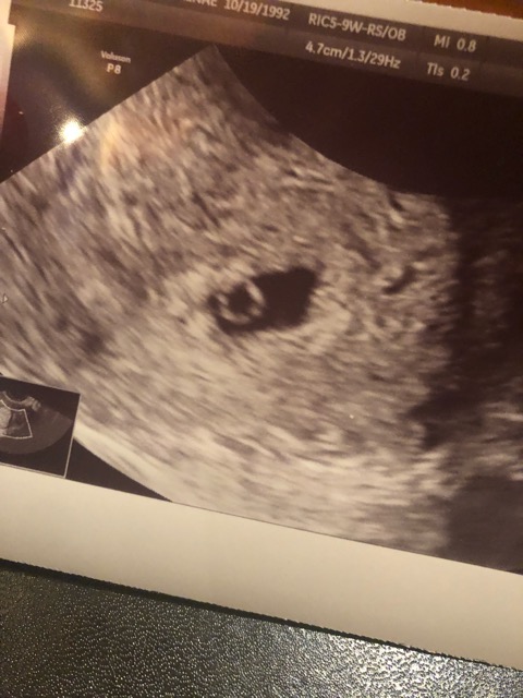 Had our first scan today! Still too tiny to see a heartbeat (also fetal ...