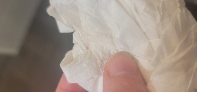 I'm TTC with PCOS. Is this implantation bleeding?? After a wipe or 2 it ...