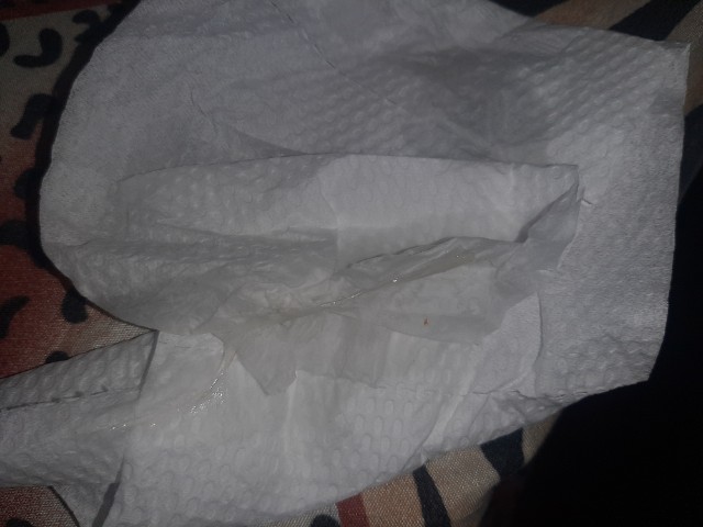 I'm 38 weeks and today's earlier today I noticed a very thick long ...