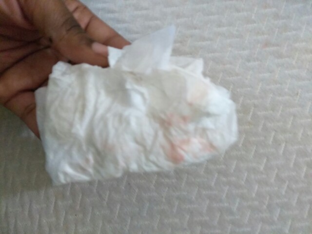 8dpo went to wipe and here's this little bit of blood. Implantation ...