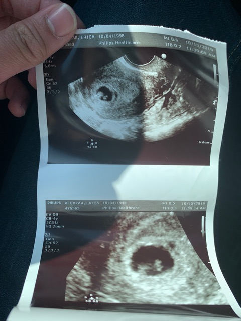 I’m officially 6 weeks today Is my first pregnancy. The doctors ...