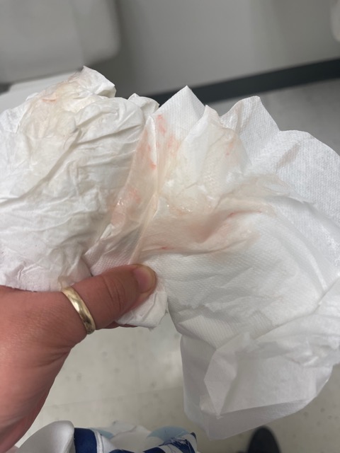 Hi Everyone- I am late 5 days on my period now and now I get this. Does ...