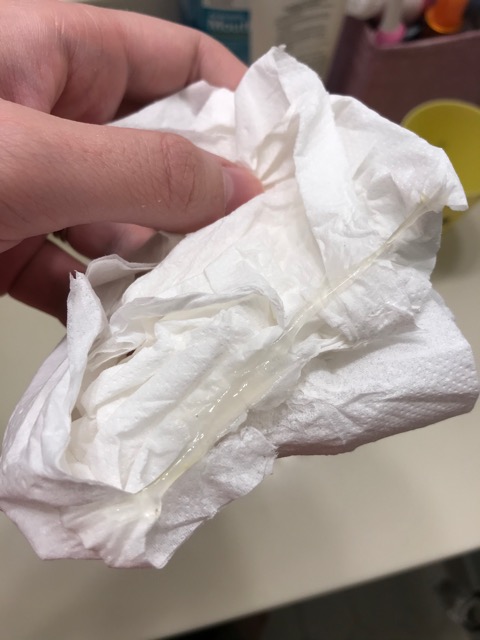 fertile or non-fertile discharge? - Glow Community