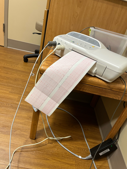 Anyone with experience with nst—I know the top section is heart rate ...