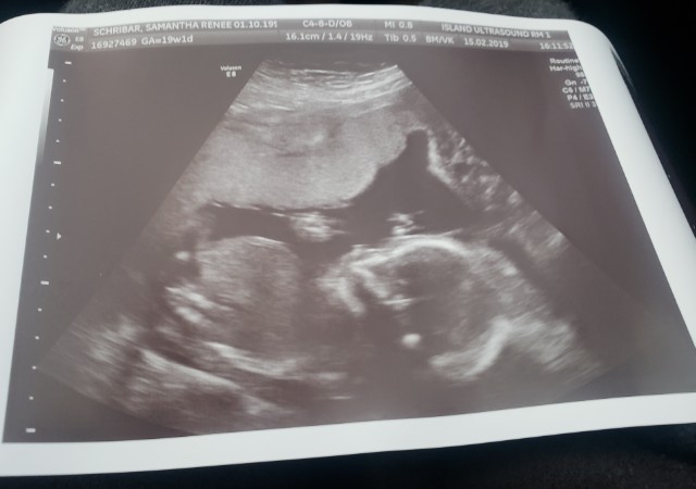 Got my 19 week anatomy scan today and so in love!! 😍. This little one ...