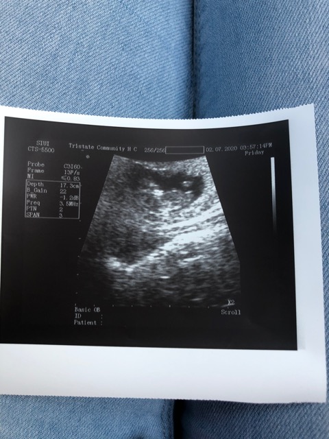 10 weeks & 5 days. Guess the gender! **JUST FOR FUN** - Glow Community