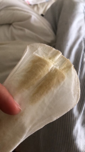 Does this look like uti discharge or something else - Glow Community