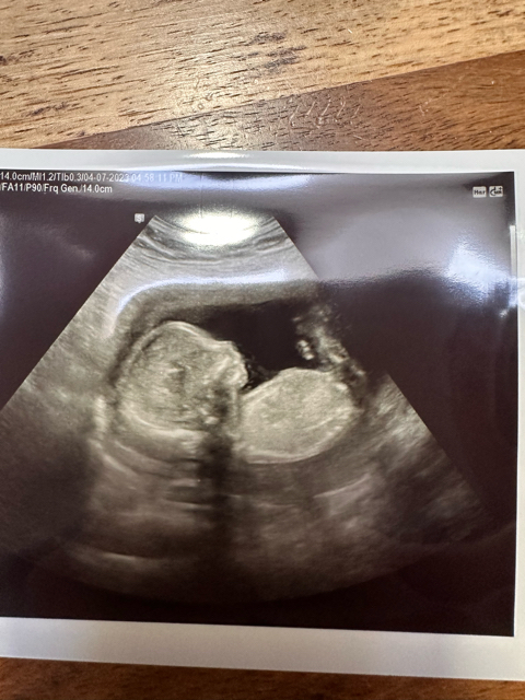 16 week ultrasound and WOW!!! Baby boy has grown so much!! We won’t ...