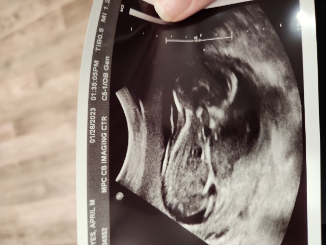 15 weeks 5 day scan. Really hoping for a girl since we already have 3 ...